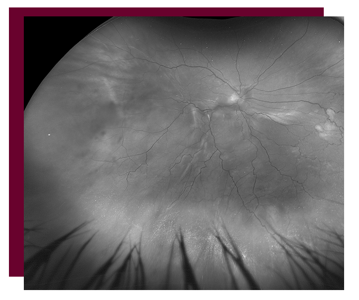 The Retina Clinic London