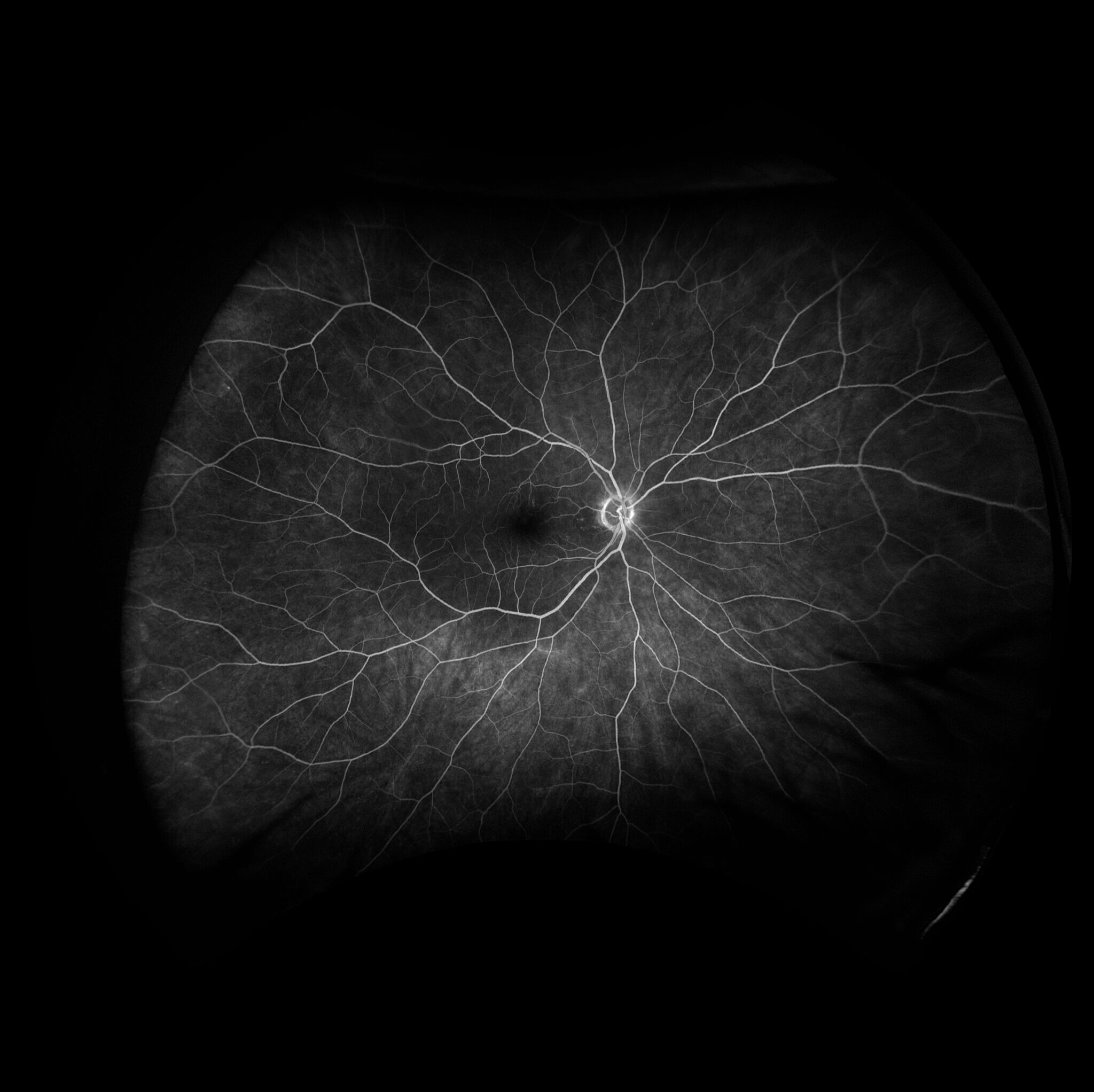 Clinical Imaging and Medical Devices - The Retina Clinic 2024