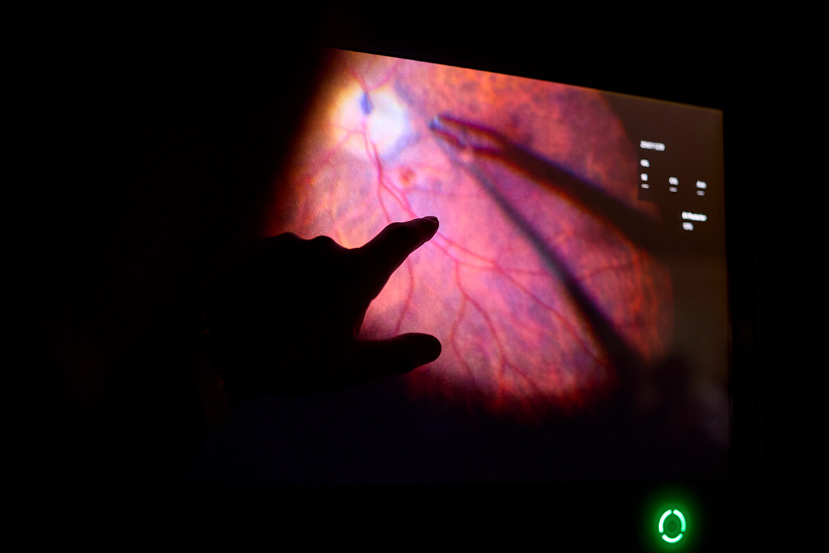 Home Page Archives - The Retina Clinic 2024